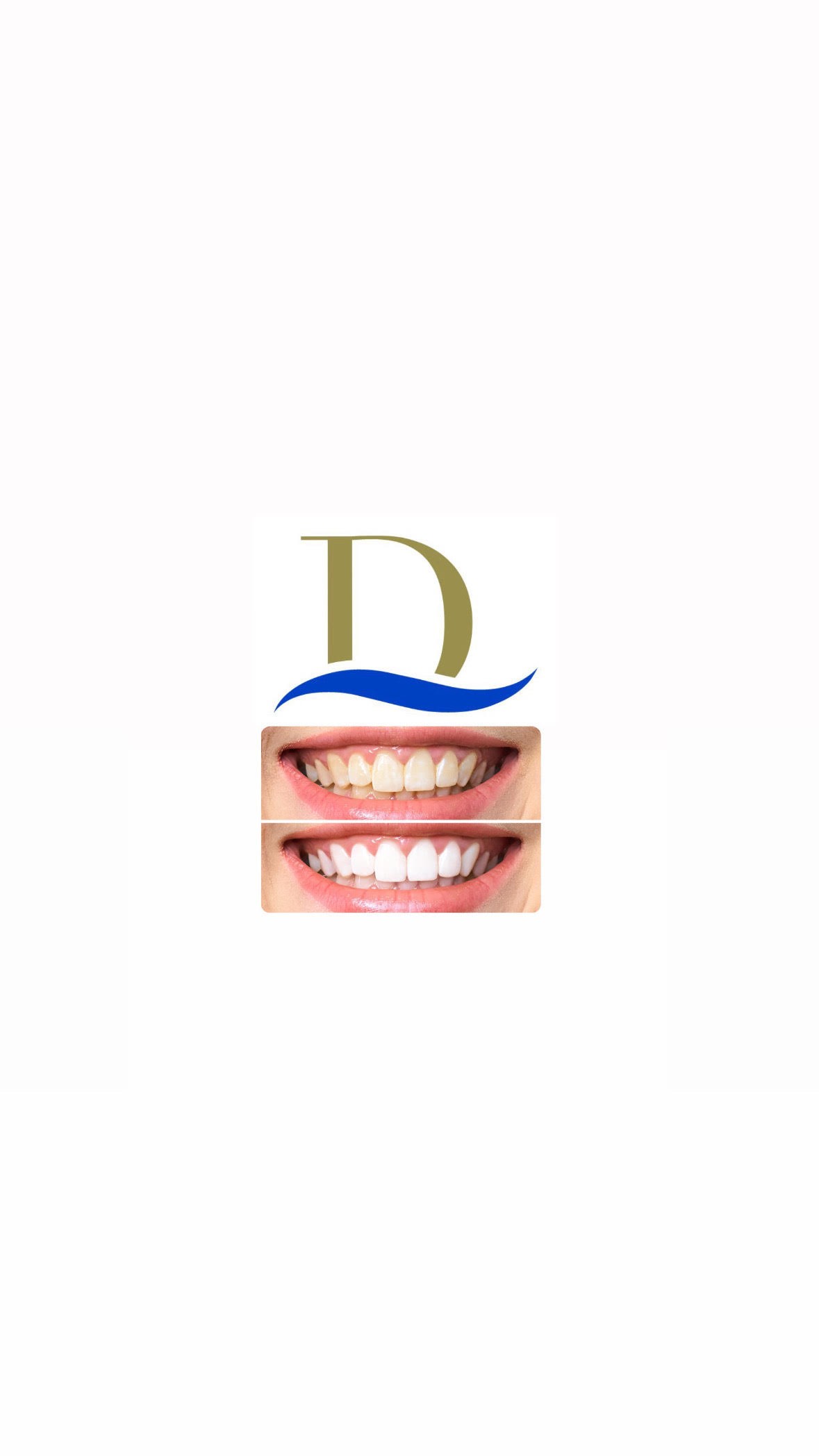 Delma Medical Center Launches Exclusive Teeth Whitening Offer